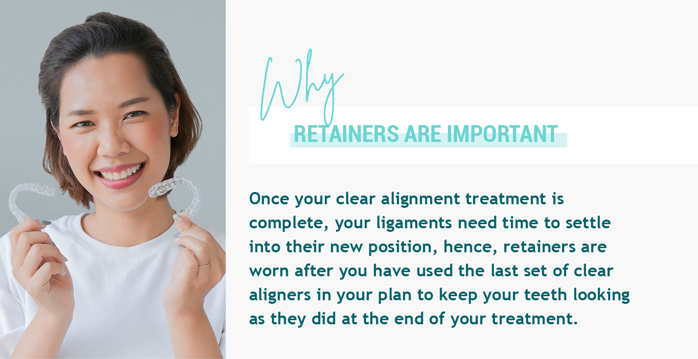 How Long Do You Have to Have a Retainer For?